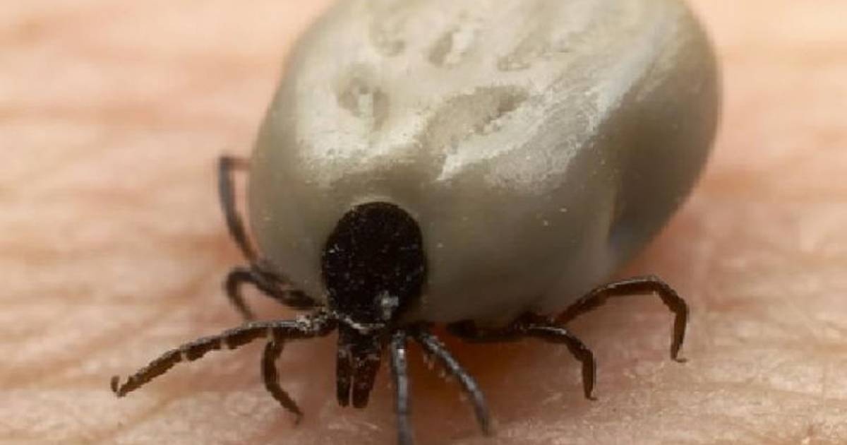 7 tips to keep you safe from ticks – Shaw Local
