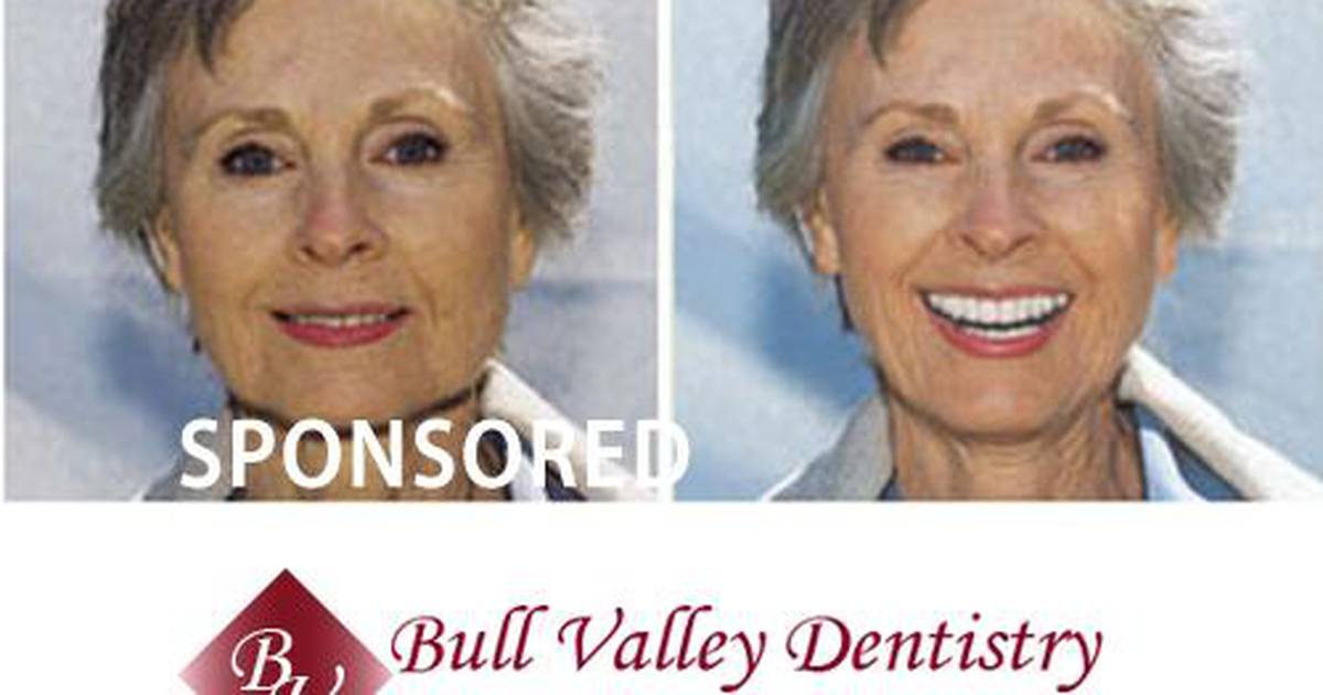 Finally...Dentures that look like real teeth – Shaw Local