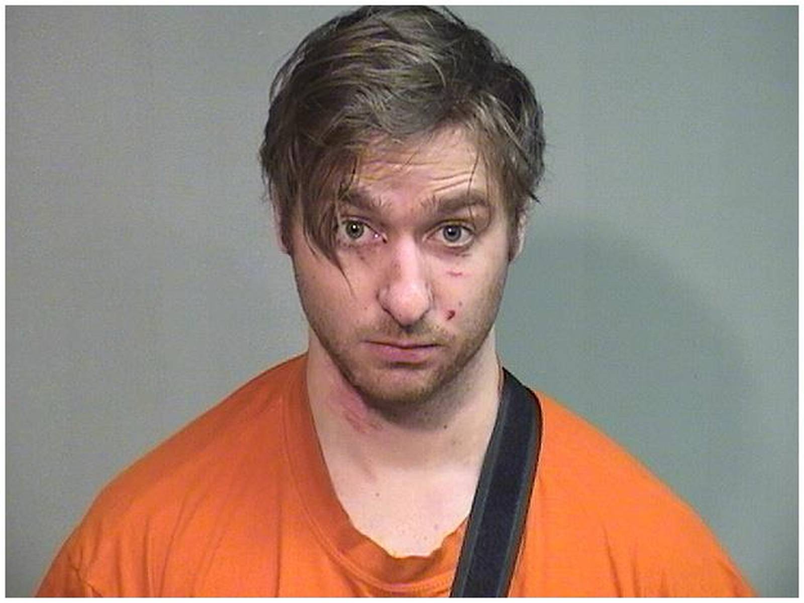 Charges Against Mchenry Man Accused Of Slashing Relative Upgraded To
